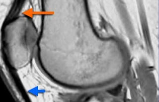 MRI Musculo-Skeletal Section: December 2011