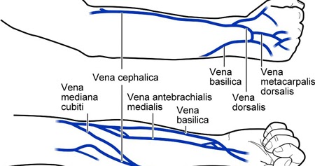 Ilmu kesehatan dan umum : lokasi vena untuk pemasangan infus