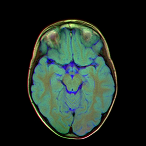 Nevit's blog: Color MRI of the Brain