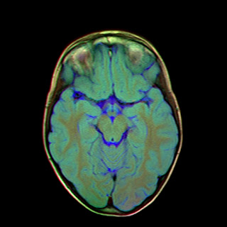 Nevit's blog: Color MRI of the Brain