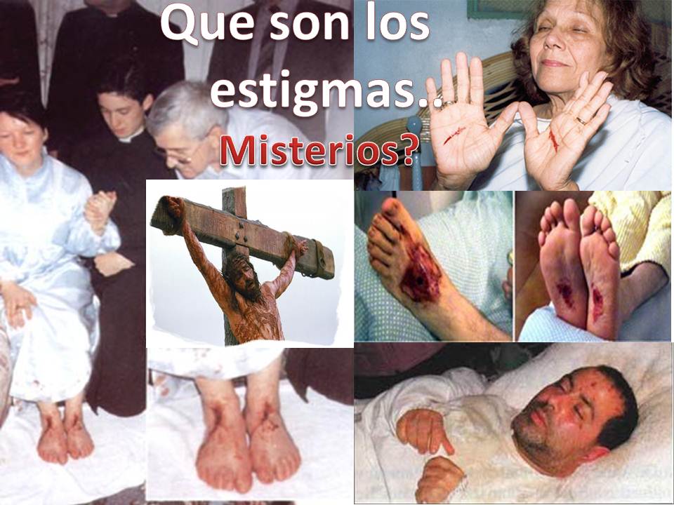 A ciência consegue explicar os estigmas defendidos pela igreja?