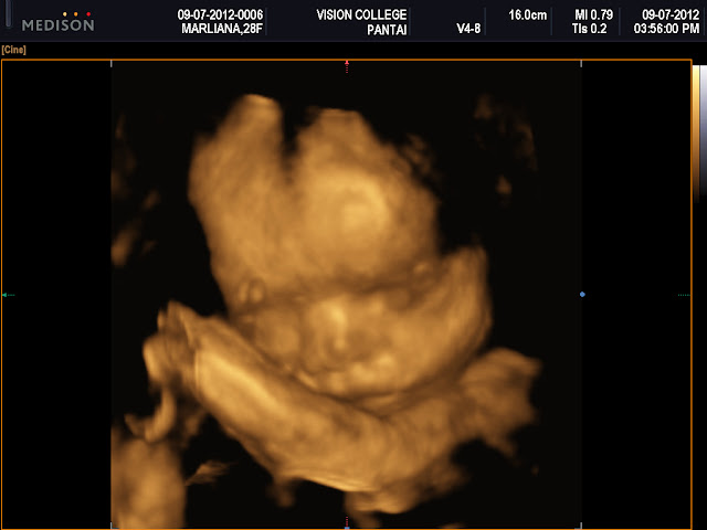My Simple but Nice Life: 3D/ 4D Scan Baby Scan - 26 Weeks Di Vision College