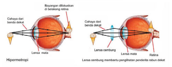 Peralatan Optik - Belajar Fisika