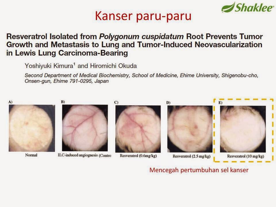 Diari KecikSangat: Menderita Kanser Paru-Paru Selama 10 Tahun Kini Sembuh