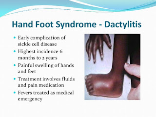 ENFERMERÍA - NURSING: ANAEMIA II