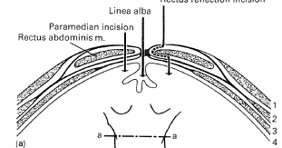 Teknik Operasi Laparotomy (Celiotomy) pada Hewan - Mydokterhewan
