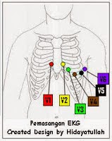 catatan perawat: PROSEDUR PEMASANGAN EKG