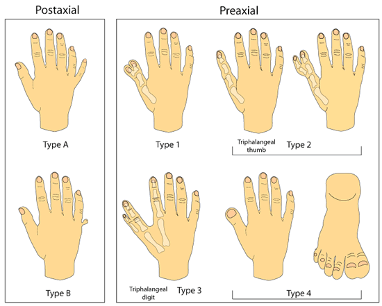 Blake's Honors Biology Blog: Your Inner Fish Chapter 3 : Handy Gene