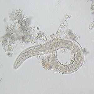 Strongyloides stercoralis - Parasitologia