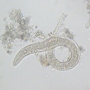 Strongyloides stercoralis - Parasitologia
