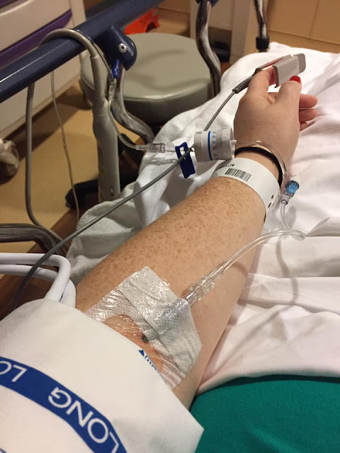 Connect the Dots Ginger | Becky Allen: Emergency Appendectomy and How ...