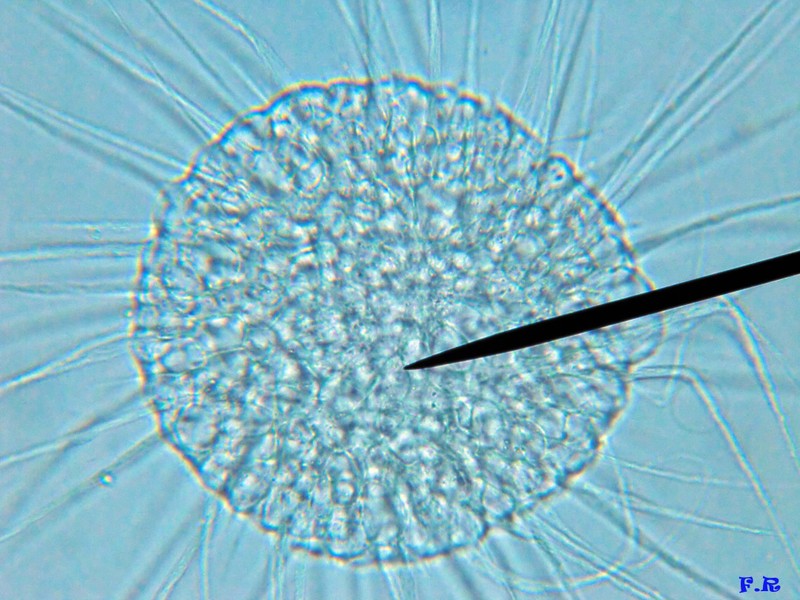 Microorganismo del agua.: HELIOZOO.