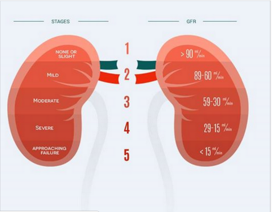 Renal-Disease-Treatment: Serum Creatinine and BUN Levels in Kidney ...