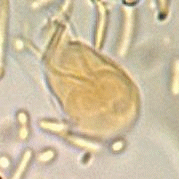 Giardia lamblia