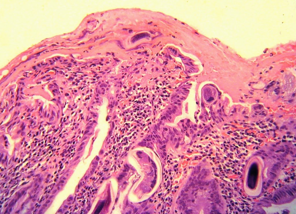 GASTROINTESTINAL AND LIVER HISTOLOGY PATHOLOGY ATLAS: DUODENUM ...
