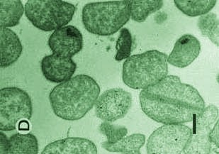 Microbe Hunter : Archaea