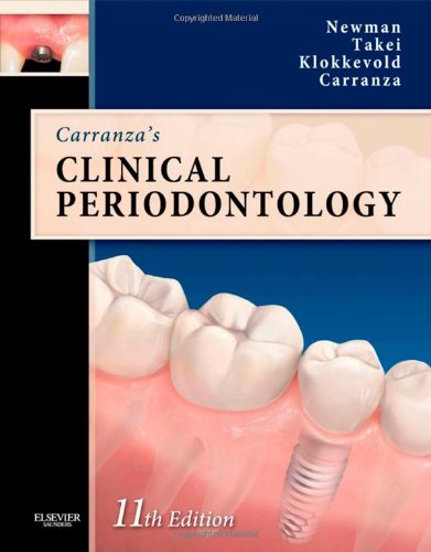 Newman: Carranza's Clinical Periodontology 11th Edition (Expert Consult ...