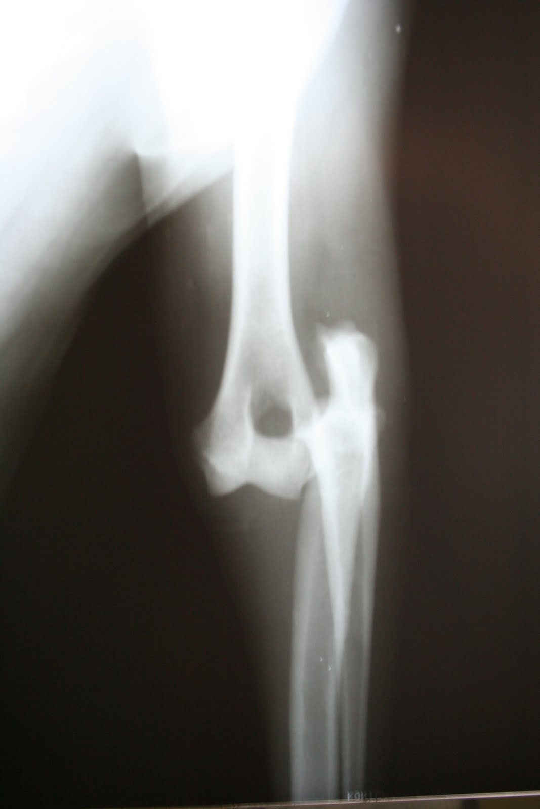 bulto amanecer Inseguro luxacion de codo en perros tratamiento estoy ...