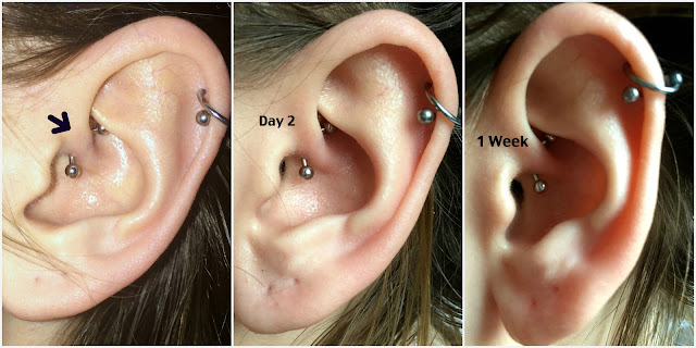 The Daith Piercing - Is It Really A Cure For Migraine? | Mammaful Zo ...