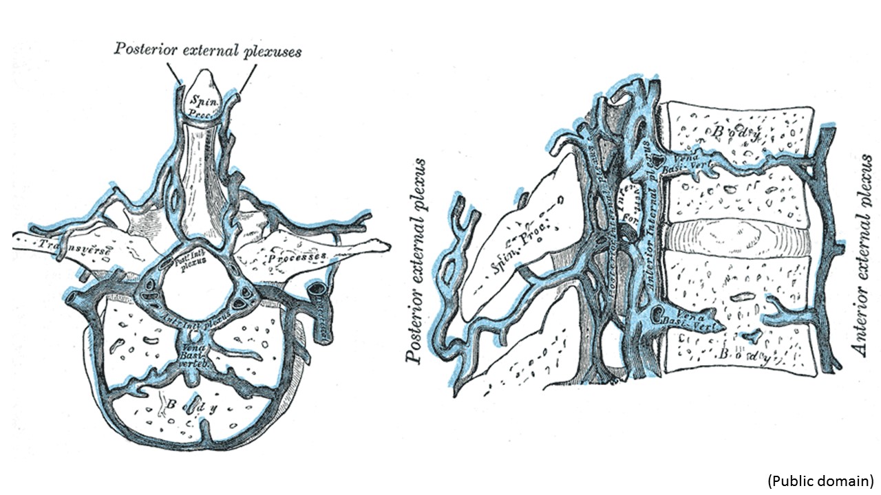 松下 ER ランチ・カンファレンス: バトソン静脈叢