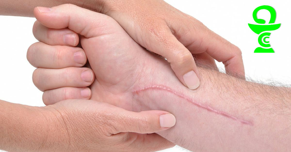 Farma Checa Online: Factores que influyen en el proceso de cicatrización