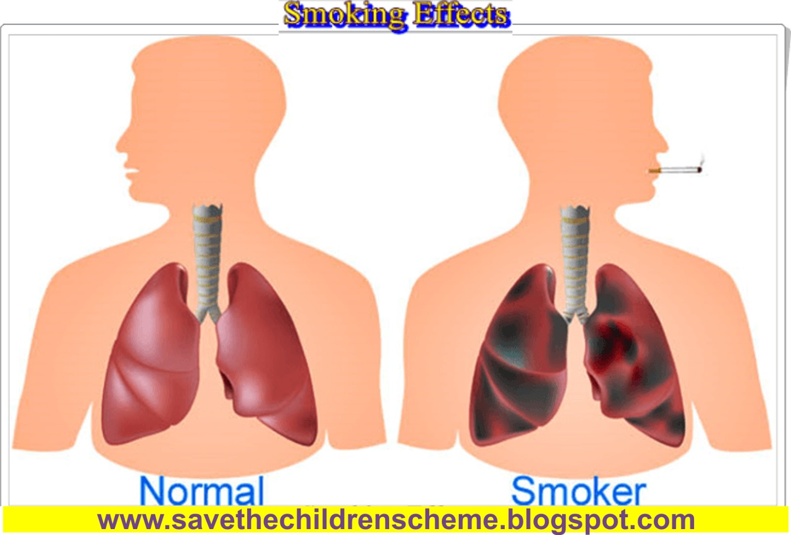 Health Effects of Cigarette Smoking - SAVE THE CHILDREN SCHEME
