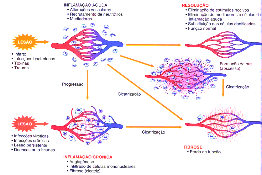 LAICI - Laboratório de Investigação de Câncer e Inflamação: Inflamação ...