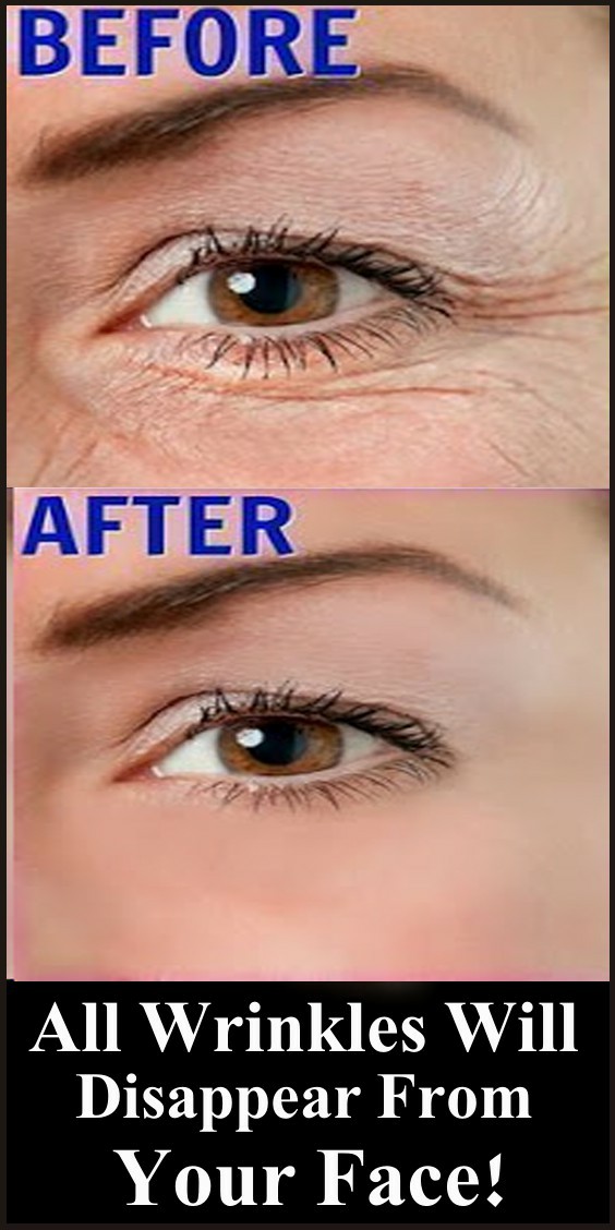 With Only 3 Uses Of This Mask All Wrinkles Will Disappear From Your ...