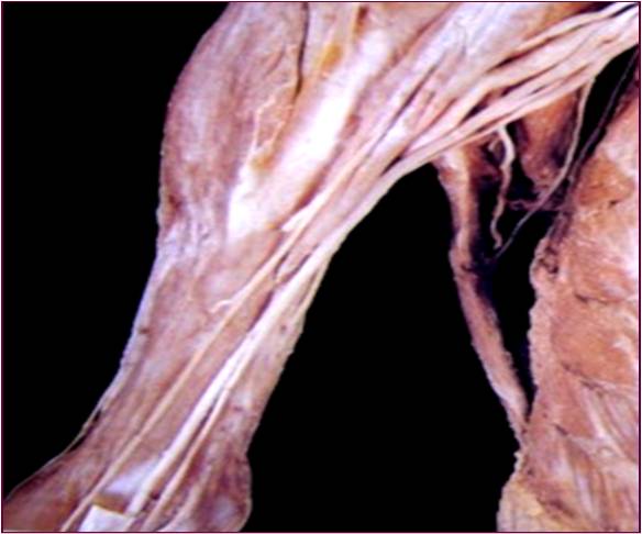 Anatomia Humana Con Marilyn Barrios: MIEMBRO SUPERIOR