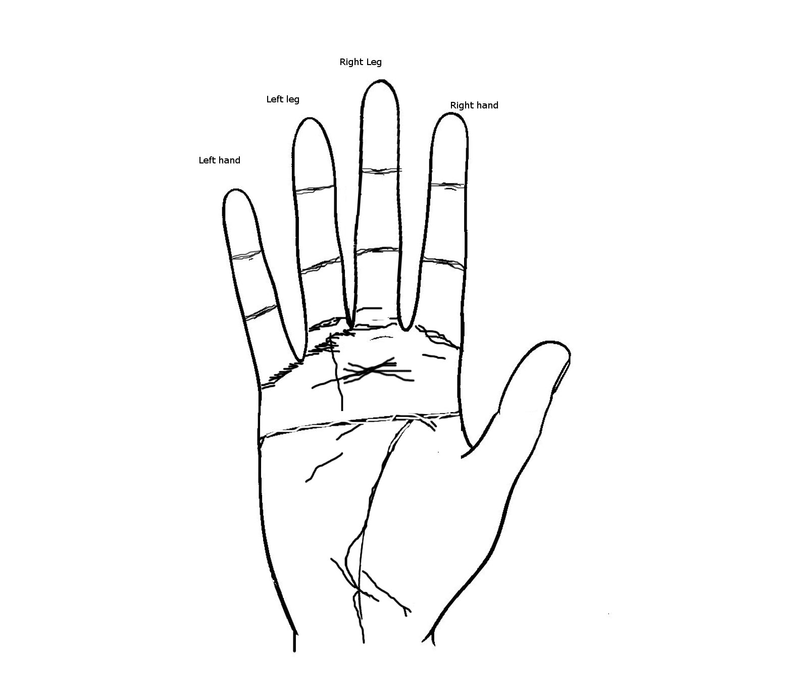 Disease to Ease: Right hand SUJOK