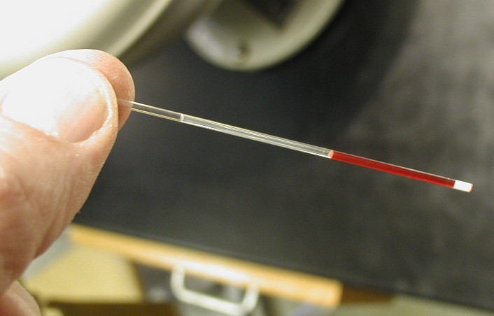 satu untuk semua: Determination of Hematocrit Value