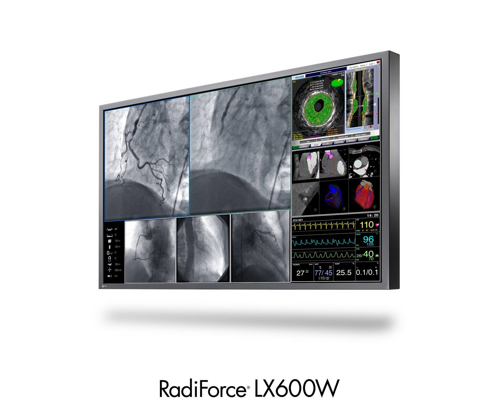Ampronix Medical Imaging: Eizo RadiForce LX600W Surgical Monitor