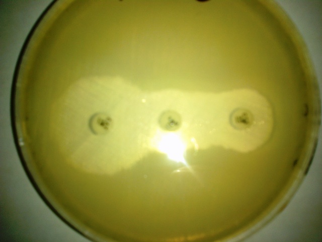 Microbiología Clínica: clases, casos interesantes y otros.