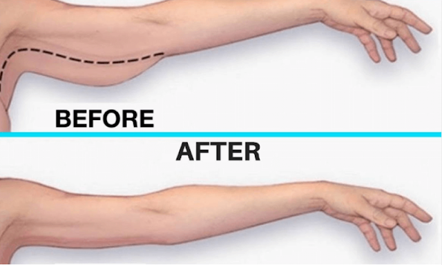 5 Best Exercises To Get Rid Of Flabby Arms! | Weight Loss & Fitness Tips