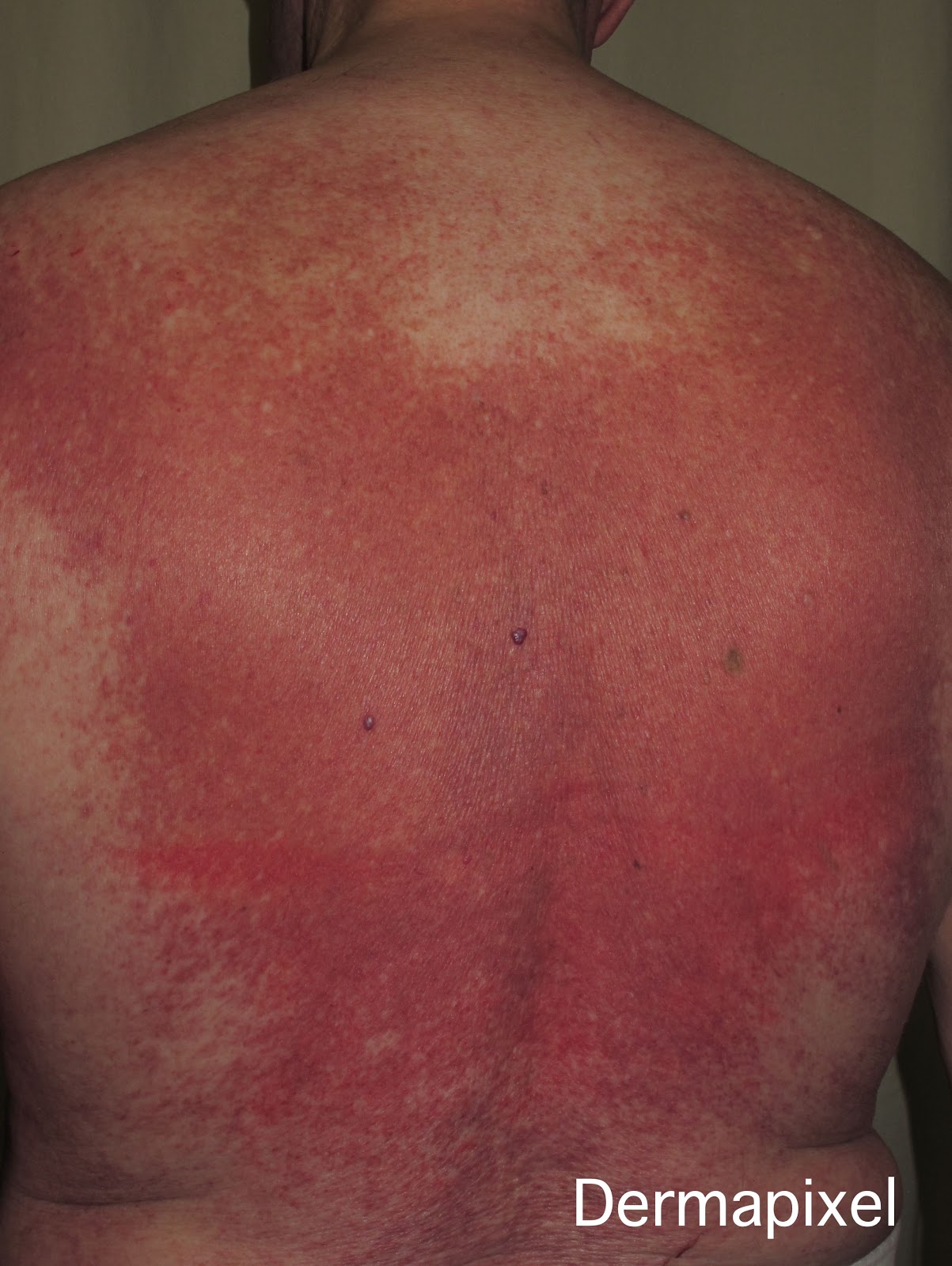 Dermapixel: enero 2019