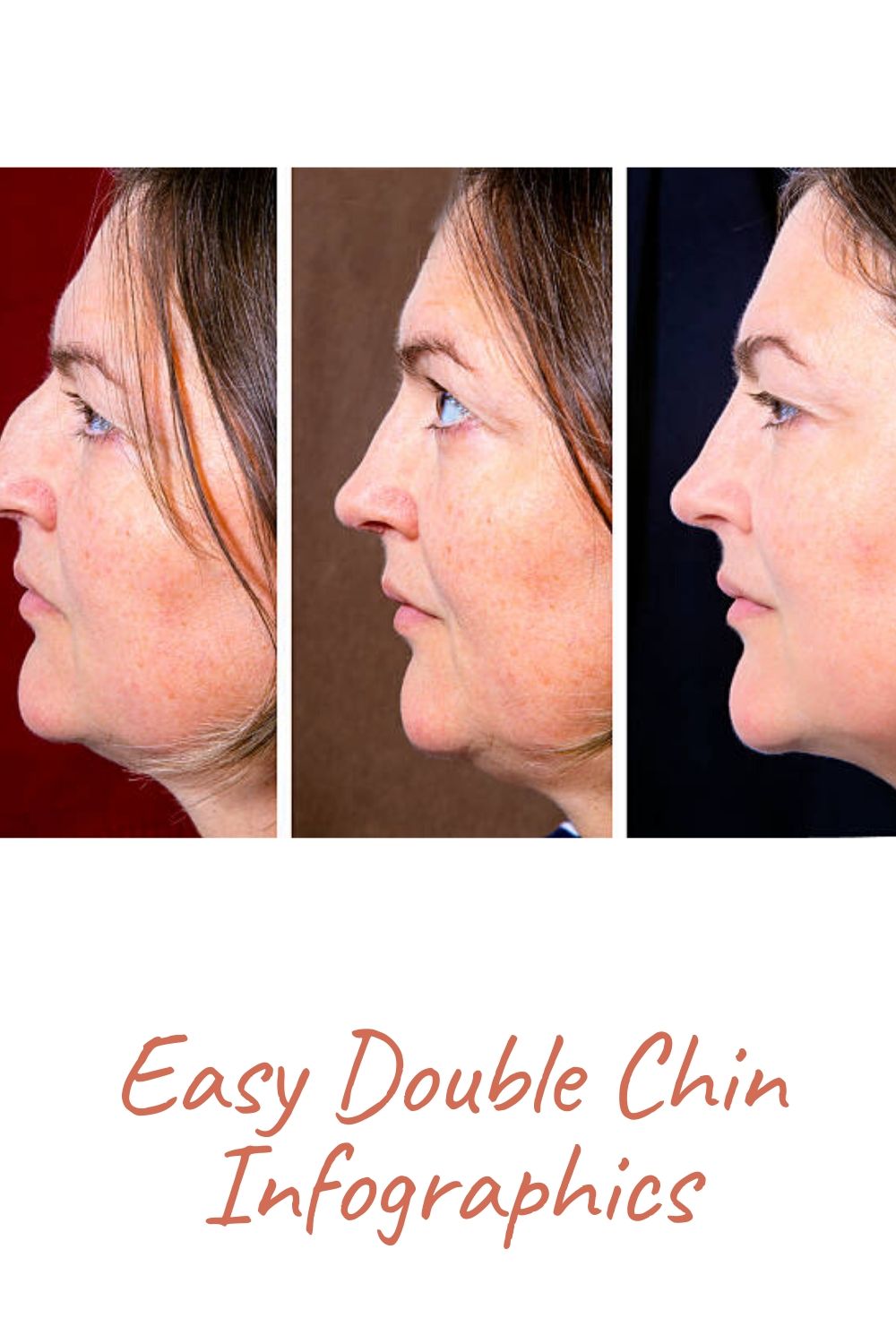 Easy Double Chin Infographics