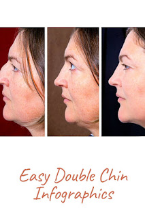 Easy Double Chin Infographics