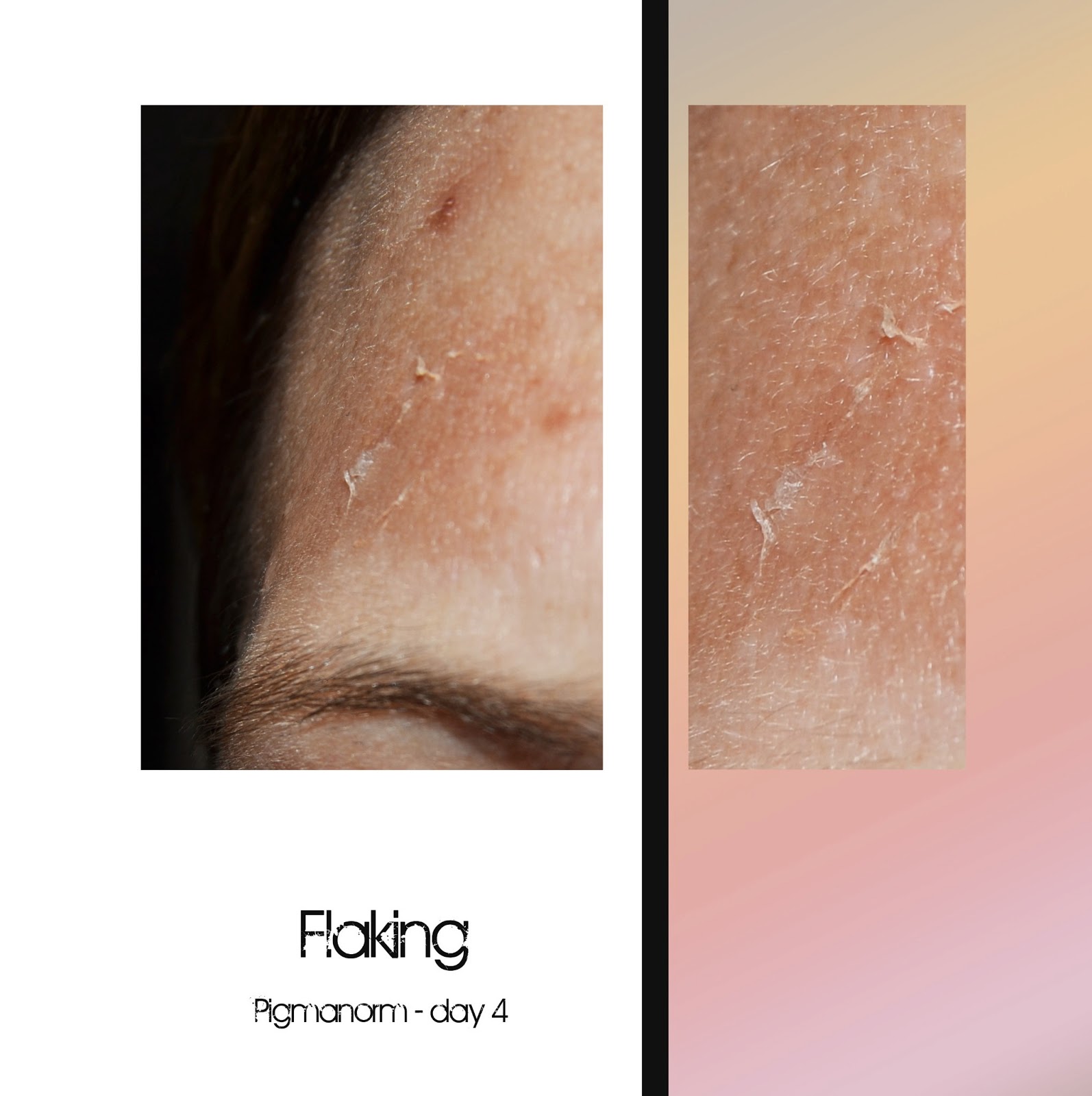 fightingmelasma.blogspot.com