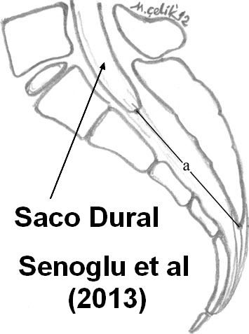 Ressonância Magnética da Hérnia de Disco - Dicionário - Fisioterapia ...