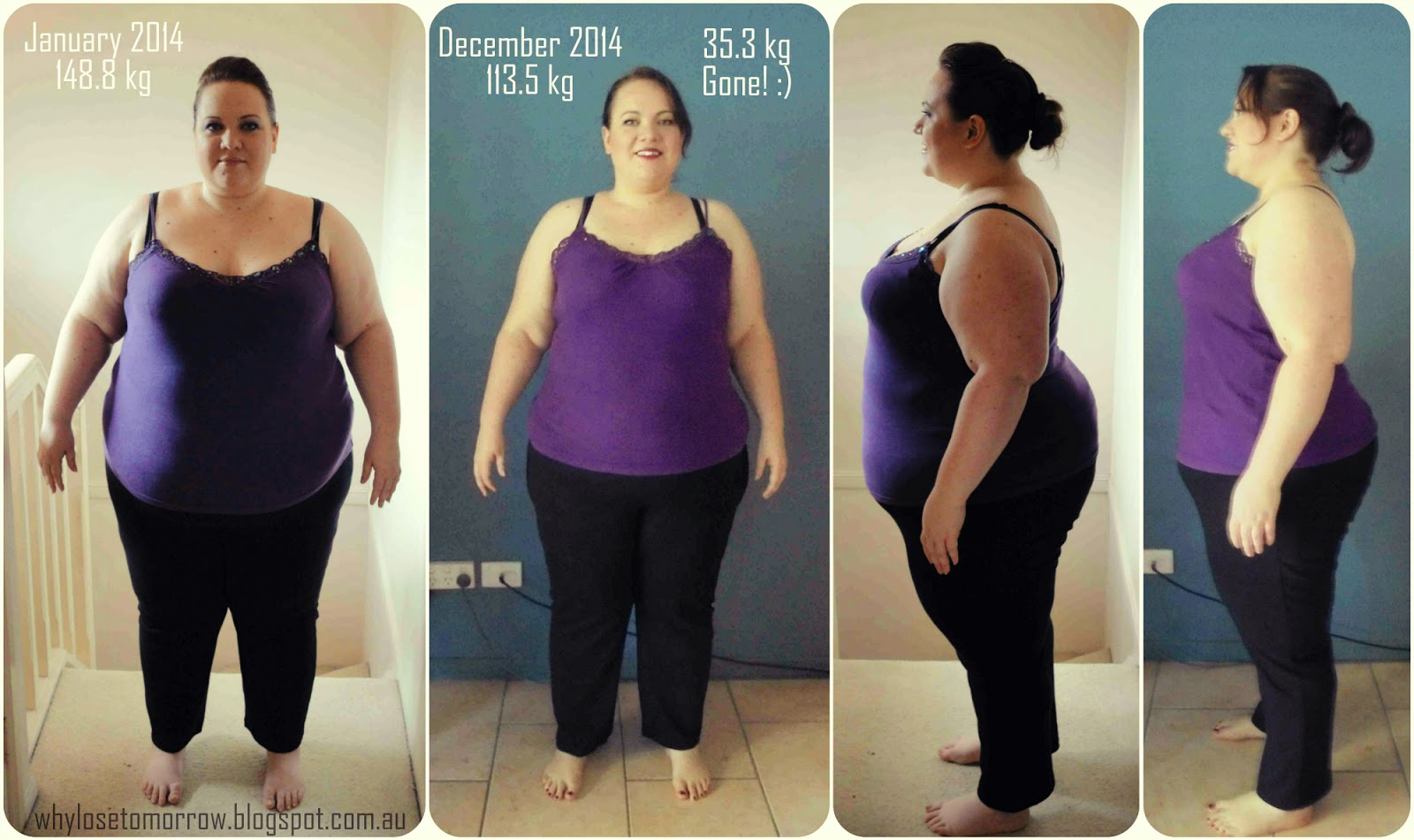 Why Lose Tomorrow My Thirty Kilo Weightloss What A Difference A Why Lose Tomorrow My Thirty Kilo Weightloss What A Difference A