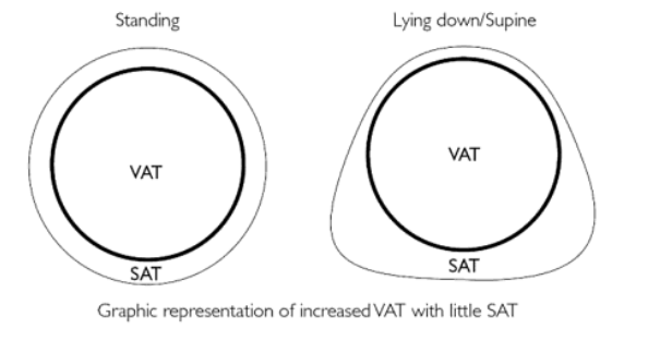 My Low Carb Road to Better Health: VAT (Visceral Adipose Tissue vs. SAT ...