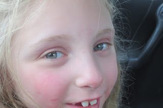 Rarer in Girls...My Daughter with Autism: Janey's various looks---pictures!