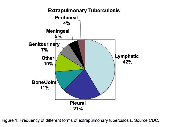 HEALTH FROM TRUSTED SOURCES: Tuberculosis