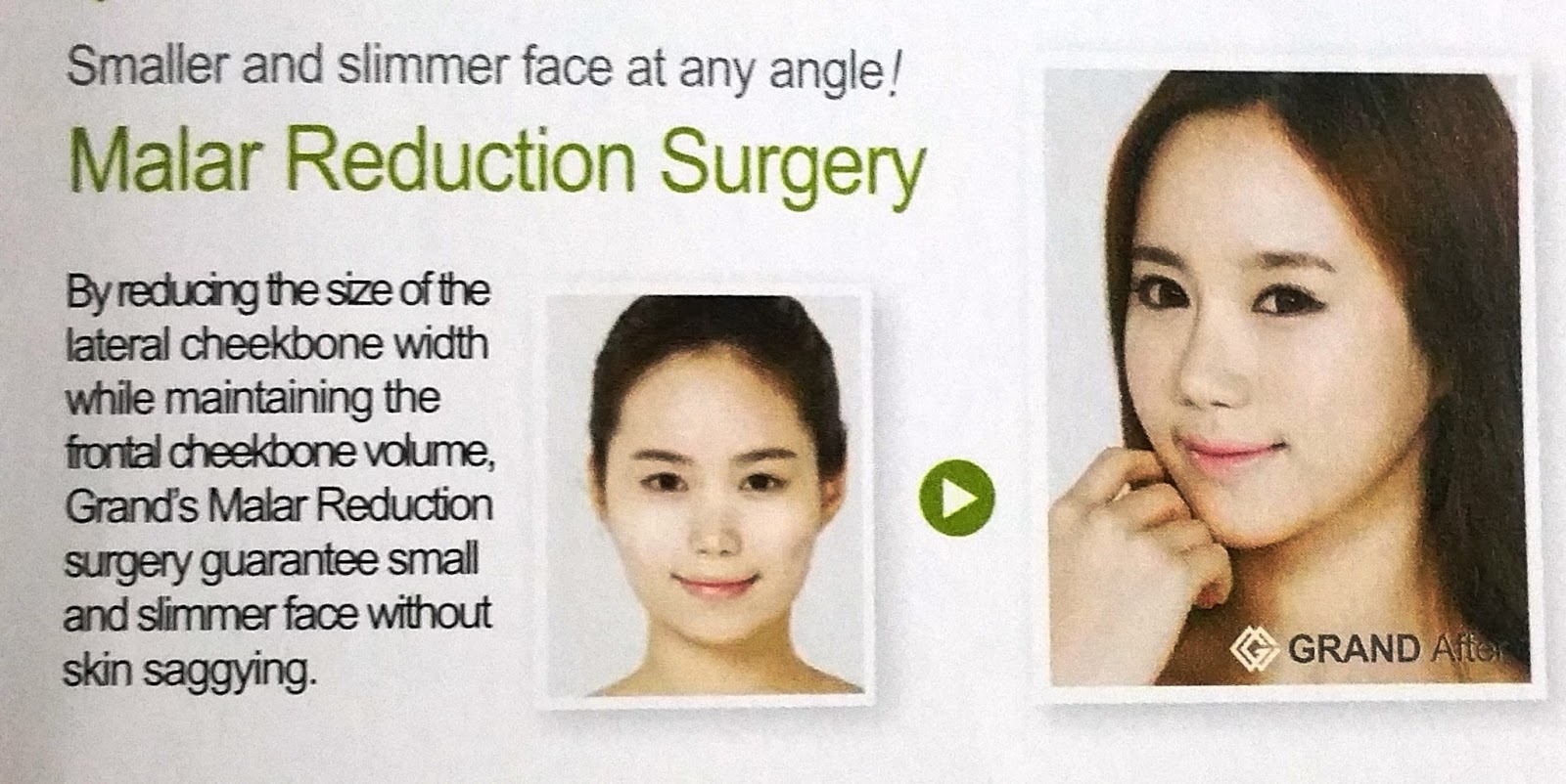 Simply Beauty: SERVICES The Secret to Looking Better Grand Plastic Surgery