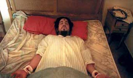 Amazing wonderful real stigmata cases - twenty ranking