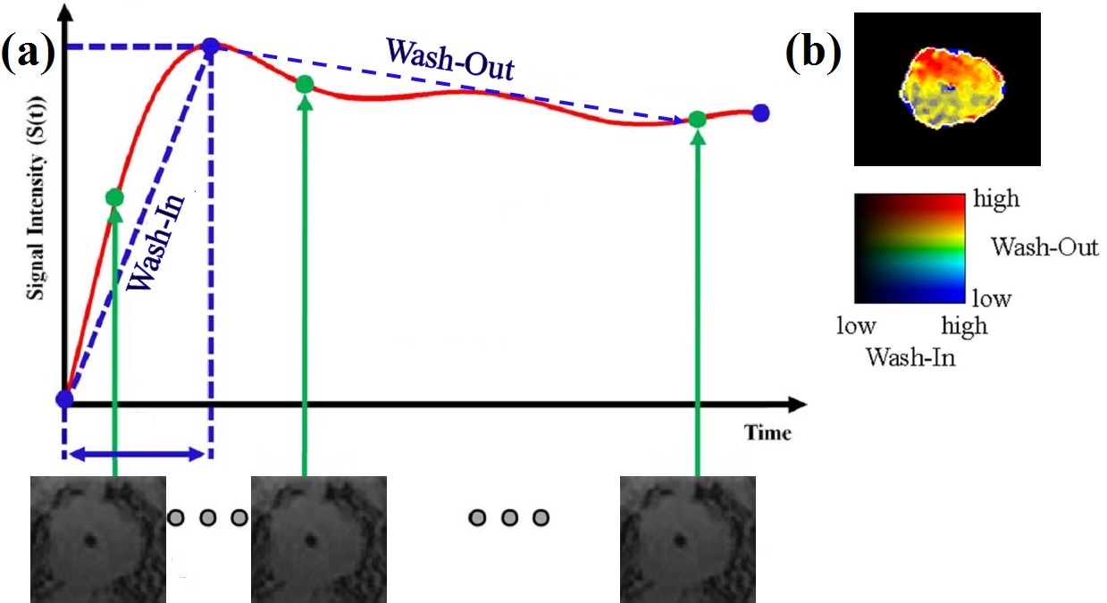 A NOVEL IMAGE-BASED APPROACH FOR EARLY DETECTION OF PROSTATE CANCER ...