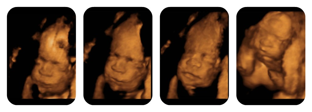 Bekkas blogg: 3D/4D Ultraljud idag :) (25+3)