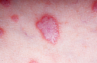 Case of the Day: Algae