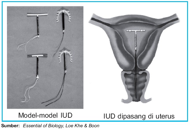 Teknologi Reproduksi pada Manusia