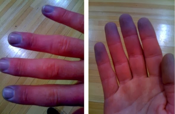 ILLNESS PRODUCED BY STRESS